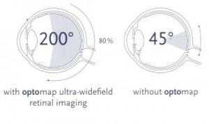 Optomap | Dumont Eye Care